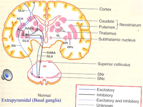 DSA Movement Disorders Flashcards Quizlet