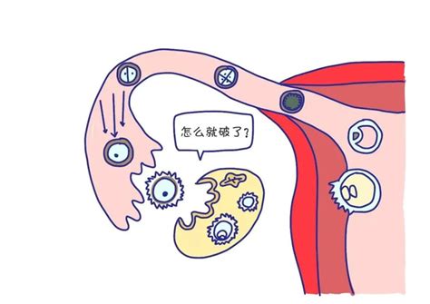 葆她科普：憋尿憋到黄体破裂？黄体到底有多脆弱 知乎