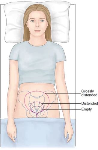 Genitourinary And Fluid Balance Assessment Flashcards Quizlet