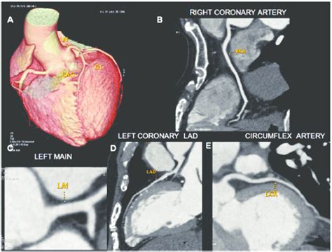 Figure Multidetector Computed Tomography Mdct Reconstructed Images Download Scientific