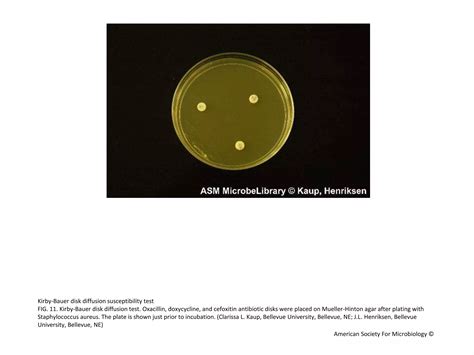 Kirby Bauer Disk Diffusion Susceptibility Test Pptx