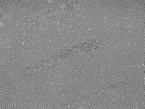 中国细胞库 Hek293 肿瘤细胞购买 苏州阿尔法生物实验器材有限公司