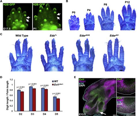 Limb Development Genes Underlie Variation In Human Fingerprint Patterns Cell