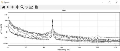 Problem Regarding The Eeg Signals Captured — Openbci Forum