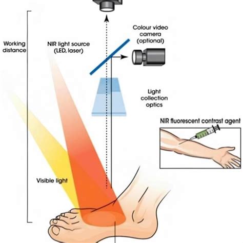 Icg Nir Fluorescence Imaging Setup Download Scientific Diagram