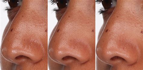 Your New Routine To Clean Clogged Nose Pores Benefit Cosmetics