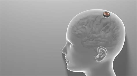 Neuralinks Hirn Computer Schnittstelle Elon Musk Will Am 30 November Neuigkeiten Zeigen T3n