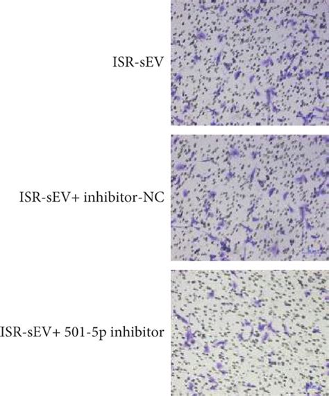 The Effect Of Mirna 501 5p On Smooth Muscle Cell Proliferation And Download Scientific Diagram