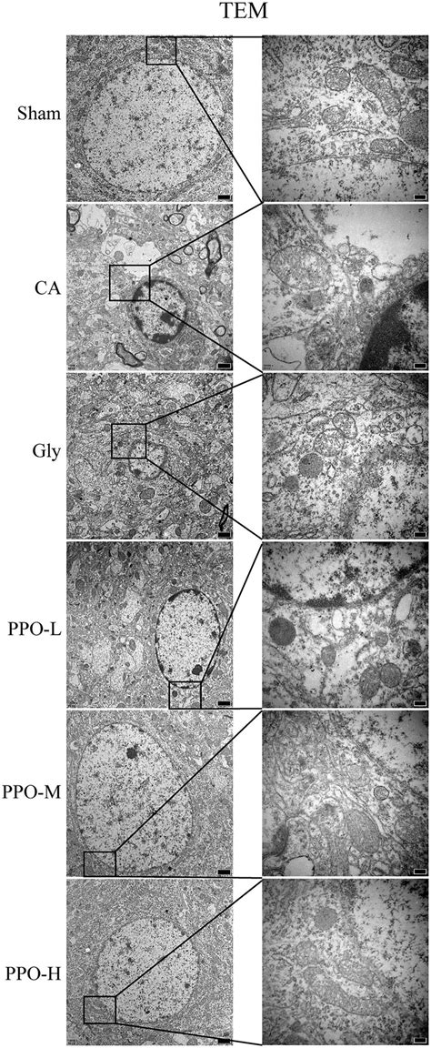 Tem Of The Rat Cerebral Cortex At 24 H After Cacpr Neuronal Cells Download Scientific Diagram