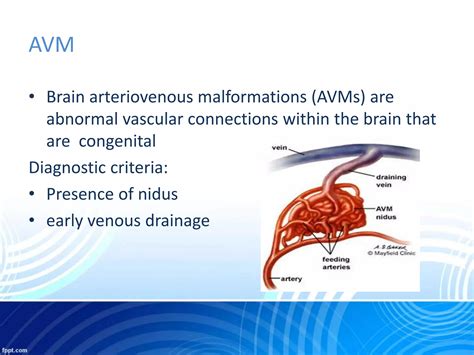 Dural Arteriovenous Fistula And Avm Pptx