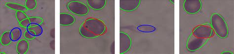 figure 1 from segmenting overlapped cell clusters in biomedical images by concave point