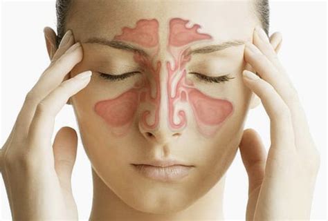 Sinusitis Causes And Symptoms Americas Best Care Plus