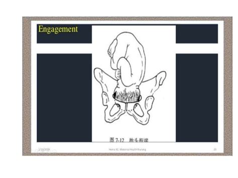 Mechanism Of Labour PPTX