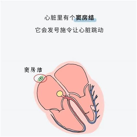 身体出现这些信号，代表心脏在向你求救！石屏sprmt许静怡