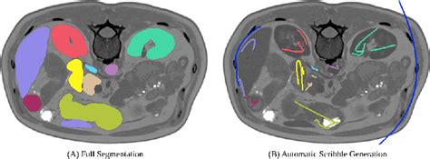 Figure 2 From Embarrassingly Simple Scribble Supervision For 3d Medical Segmentation Semantic