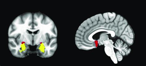 Regions Of Interest Including Left The Basolateral Amygdala Yellow Download Scientific