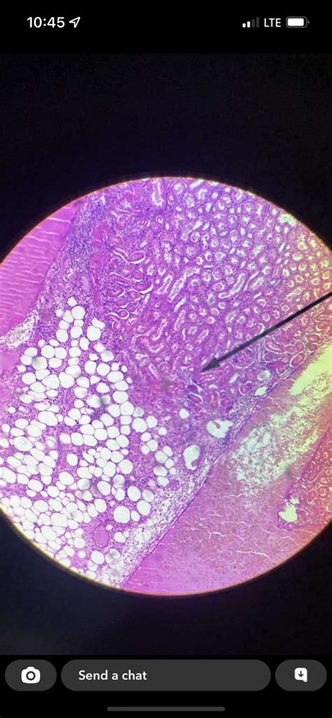 Squamous Epithelium Squamous Anatomy And Physiology Physiology