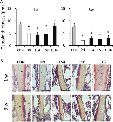 Histomorphometric Findings Of Osteoid Thickness And Light Microscopy Of