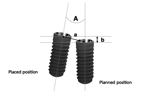 Diagram Of Variables For Describing Deviation Download Scientific Diagram
