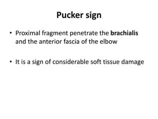 Supracondylar Fractures Of The Distal Humerus Ppt