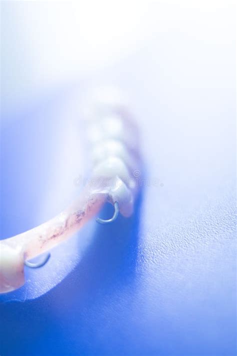 Removable Partial Dentures Stock Photo Image Of Orthodontics 64266602