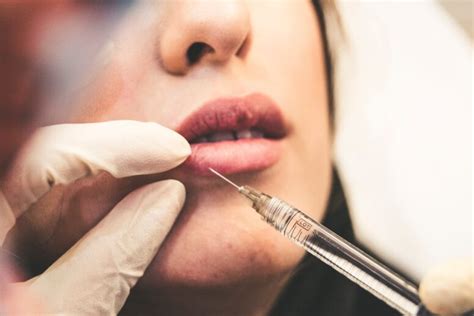 Preventative Botox A Proactive Approach To Aging Gracefully