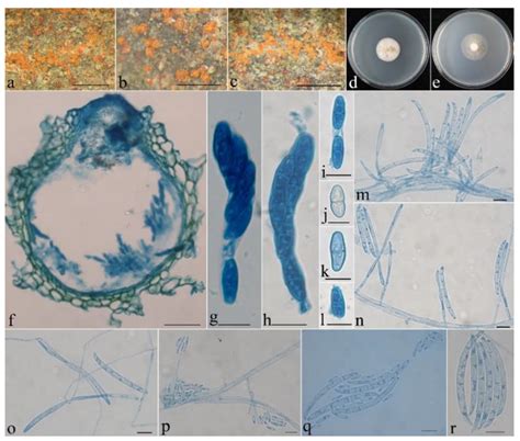 Ascomycota Microscope