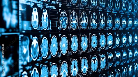 Advanced Machine Learning Algorithm For Highly Accurate Disease