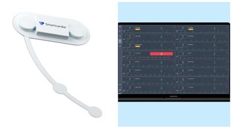 SmartCardia Receives FDA Approval For Its 7 Lead ECG Real Time Patch