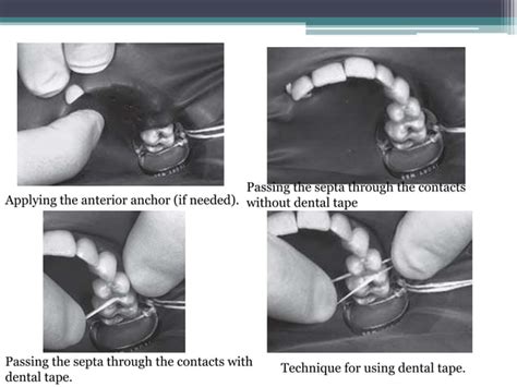 Isolation Types Advantages And Disadvantages Ppt