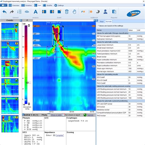 Solar™ Gi High Resolution Pharyngeal Manometry Laborie Eu