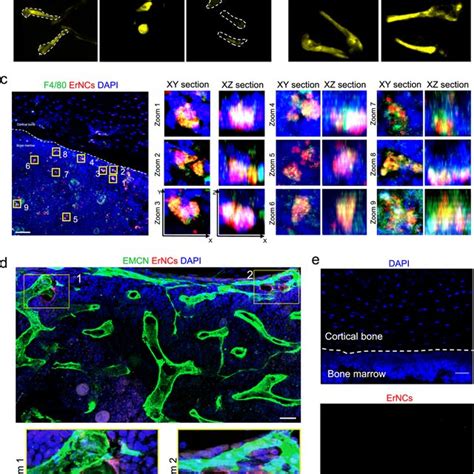 High Resolution Nir Ii Imaging Of Mice Bones In Both Two And Three