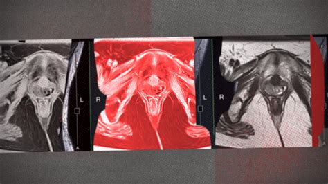 What S An Inverted Uterus Here S What You Need To Know About One Of The Most Serious