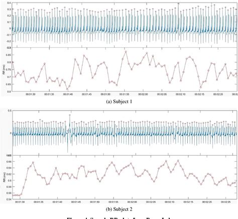 Figure 4 From Monitoring Physiological State Of Drivers Using In Vehicle Sensing Of Non Invasive
