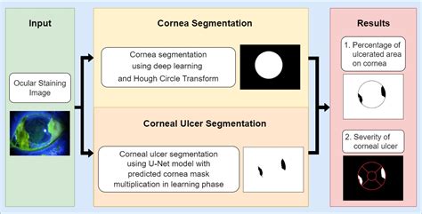 A Segmentation Based Automated Corneal Ulcer Grading System For Ocular
