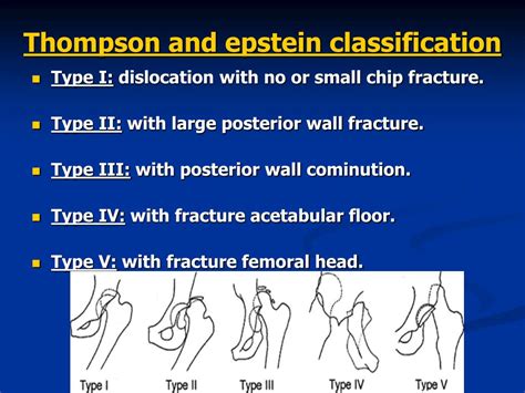 Ppt Injuries Of The Hip And Femur Powerpoint Presentation Free