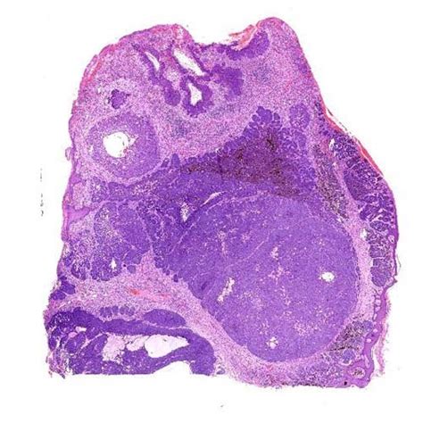 General Pathology Glass Slides Thickness 1 2mm At 600 Piece In Noida