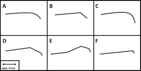 How To Select A Guidewire Technical Features And Key Characteristics