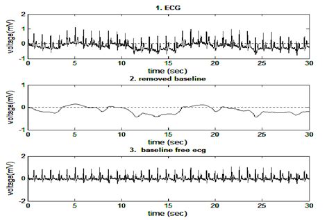 Ecg1 Mitbih Rec108 With B0 Baseline Download Scientific Diagram