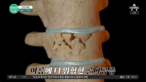 여름에 골절 사고가 더 높은 이유는 50대 여성들에게 치명적인 골다공증 여성호르몬 골다공증 보다