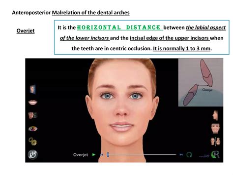 Classification Of Occlusion And Malocclusion Dr Nabil Al Zubair Ppt
