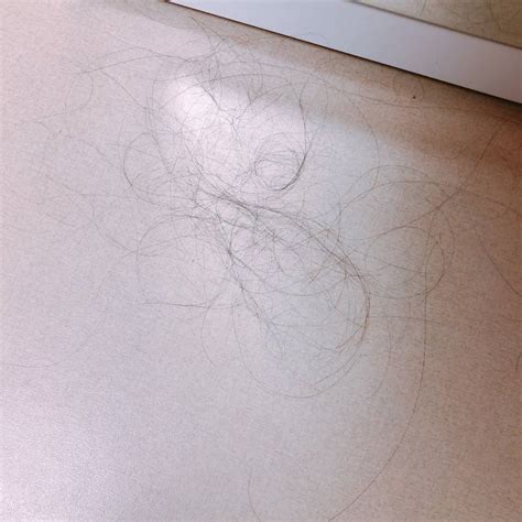 익들아 나 이거 탈모증상이니ㅠㅠㅠㅠ 인스티즈instiz 일상 카테고리