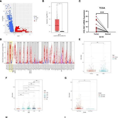 又见肿瘤预后文章套路：col10a1的预后价值及其与膀胱尿路上皮癌肿瘤浸润免疫细胞的相关性 Pmid 37006317 知乎