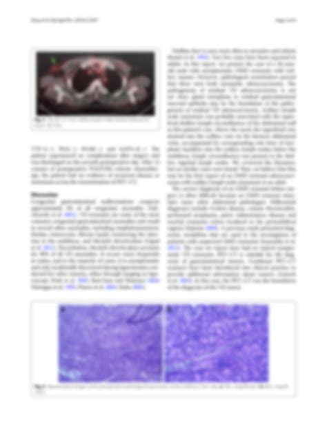 Solution Omphalomesenteric Duct Remnant Adenocarcinoma In Adults A