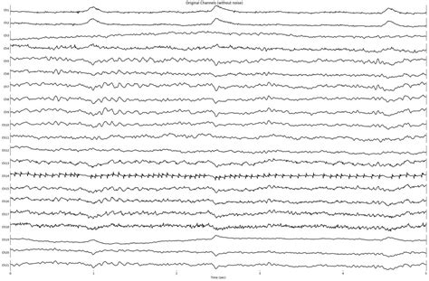 arya koureshi on linkedin eeg datascience neuroscience signalprocessing machinelearning