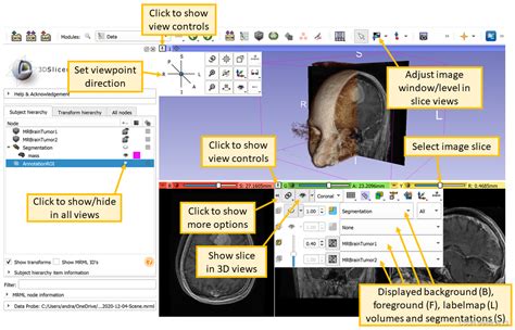 3d slicer：从入门到精通（二）——入门指南 3dslicer csdn博客