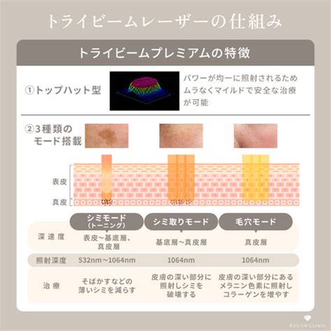 トライビームレーザーの肝斑やニキビ跡への効果を口コミから調査！当院厳選の併用施術も紹介 Kyu En Clinic（キュウエンクリニック）