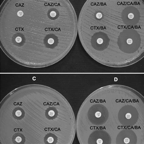 Representative Results Of The Clsi Esbl Confirmatory Test A And C And
