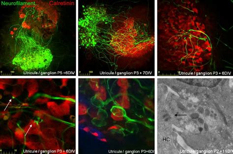 Post Lesional Plasticity Of Primary Vestibular Neurons In Cocultures Of Download Scientific