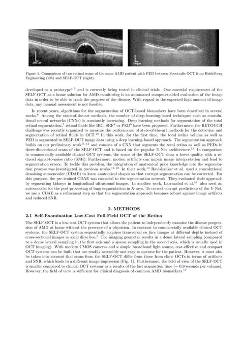 Segmentation Of Retinal Low Cost Optical Coherence Tomography Images Using Deep Learning DeepAI